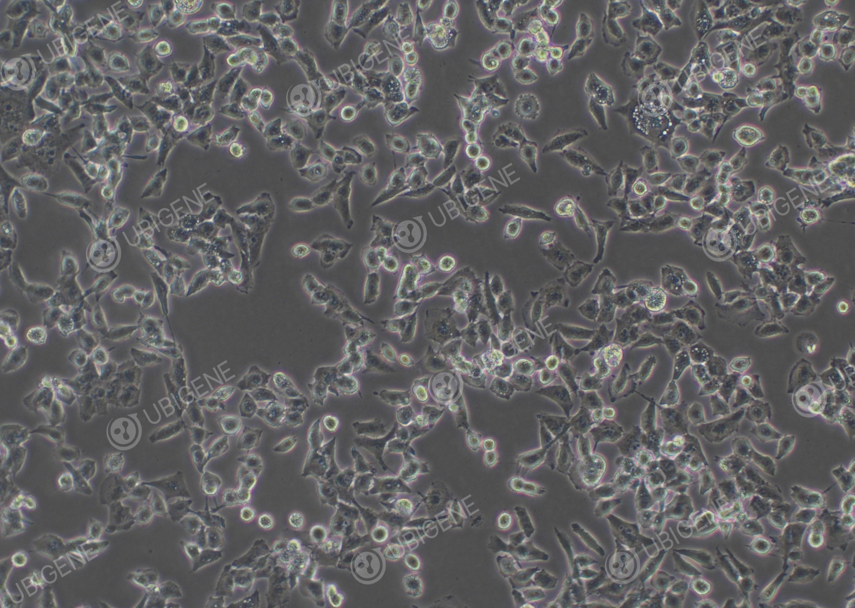人肝癌细胞(SMMC-7721)_源井生物【官网】