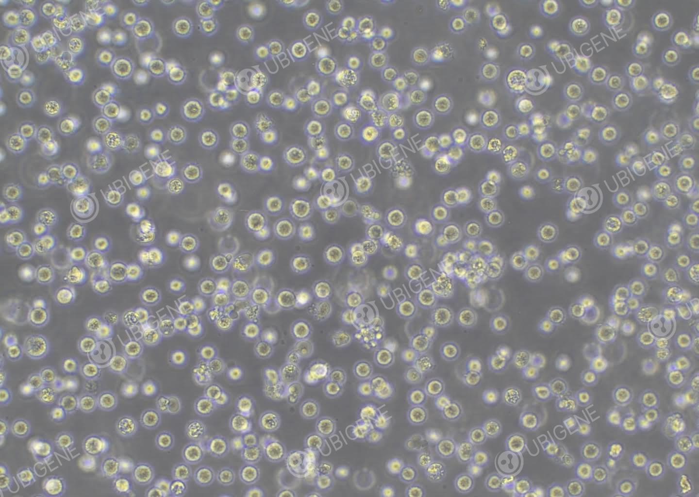 SU-DHL-4-CAS9 cell line | Ubigene
