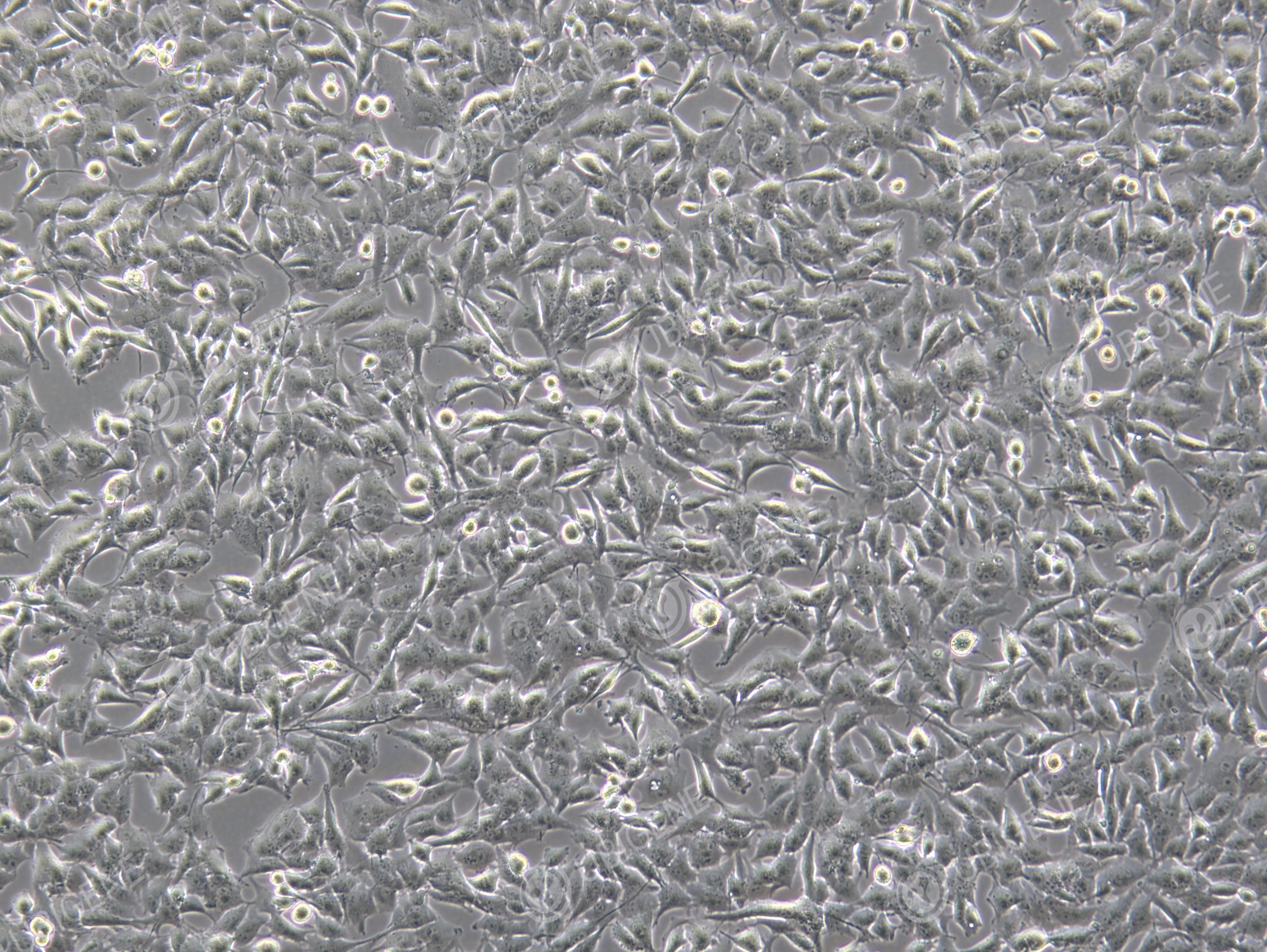 人脑胶质母细胞瘤细胞(T98G)_源井生物【官网】